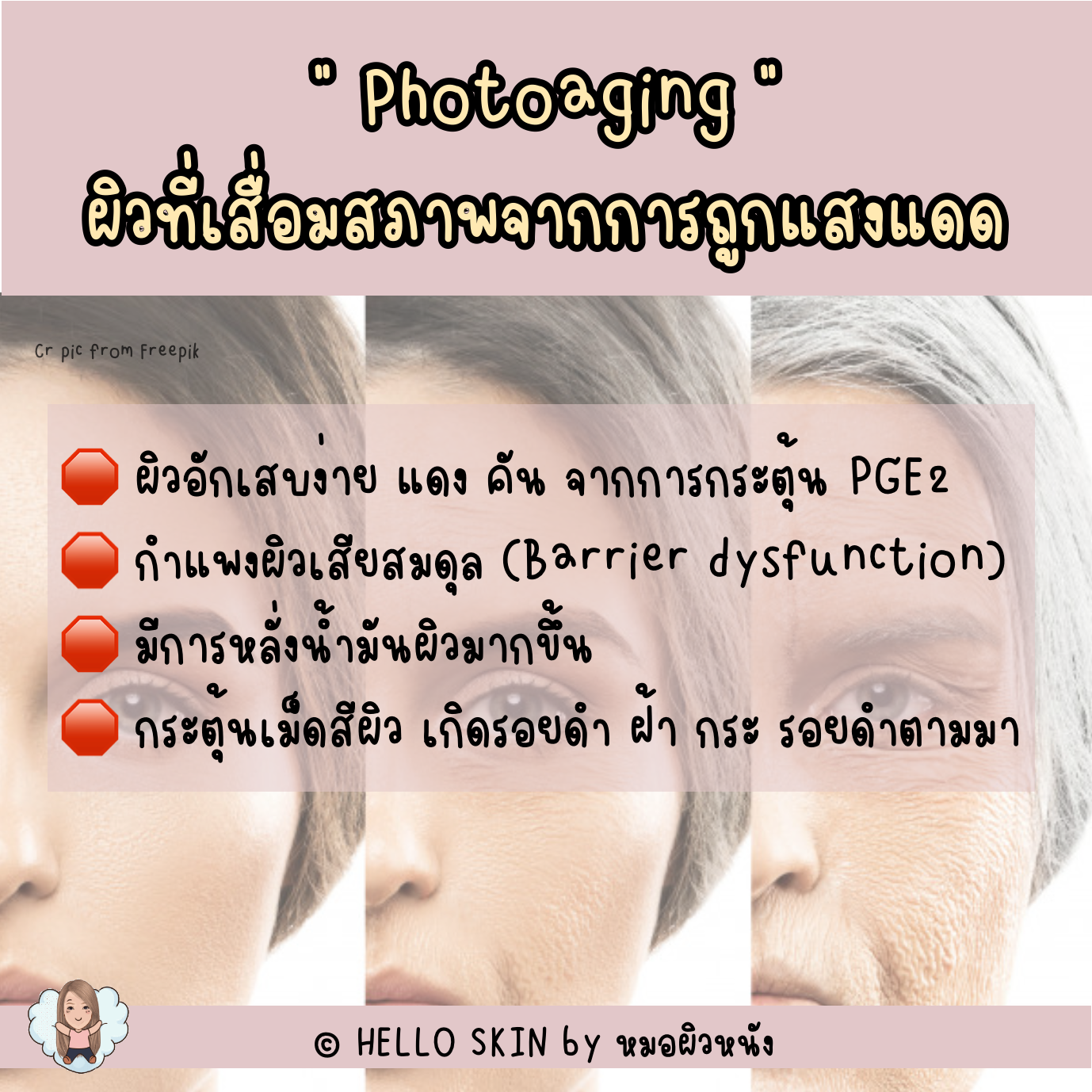 UV & Skin Photoaging🌤👴🏻 | HELLO SKIN by หมอผิวหนัง
