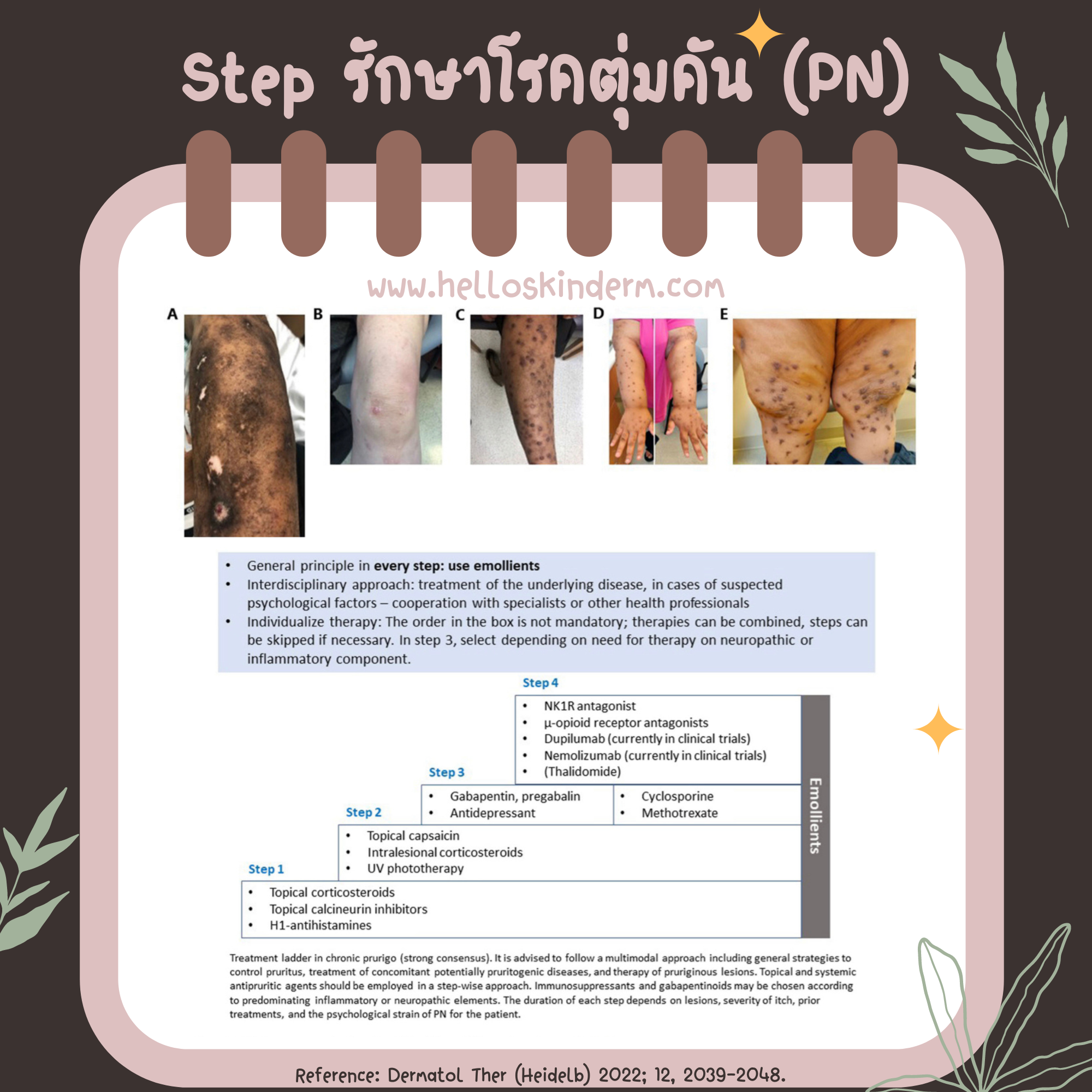 Update and Management ตุ่มคัน (Prurigo nodularis) 2022 | HELLO SKIN by ...