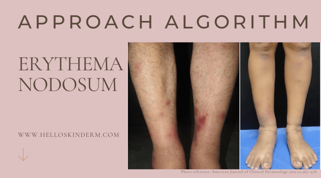 Erythema nodosum (Update 2021) : Approach algorithm | HELLO SKIN by หมอ ...