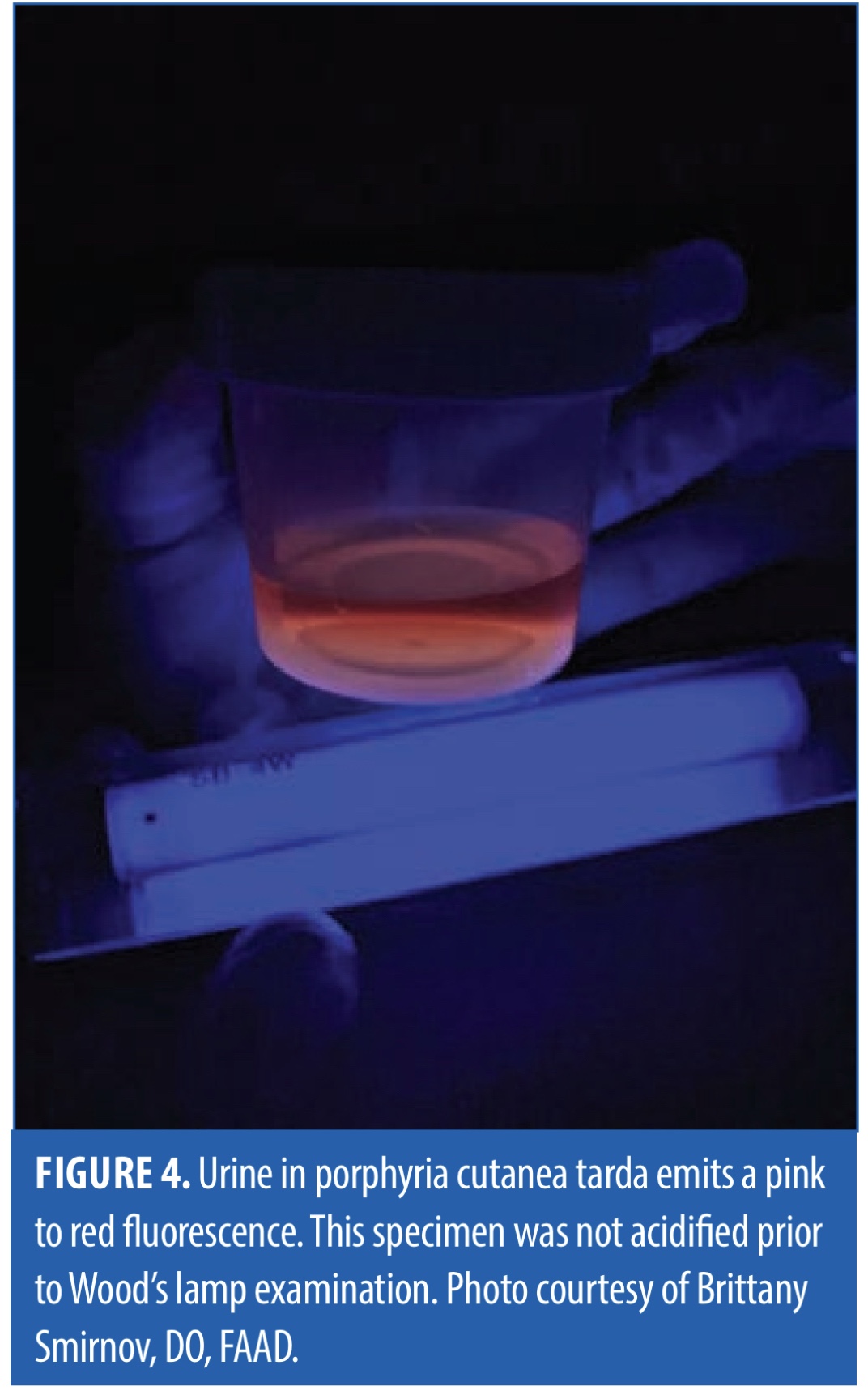 สรุปโรคและสีที่มองเห็นจาก Wood’s Lamp Examination | HELLO SKIN by หมอ ...